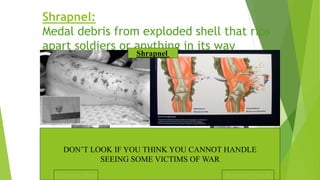 Trench diagram n artilleries of ww1 | PPT