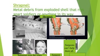 Trench diagram n artilleries of ww1 | PPT
