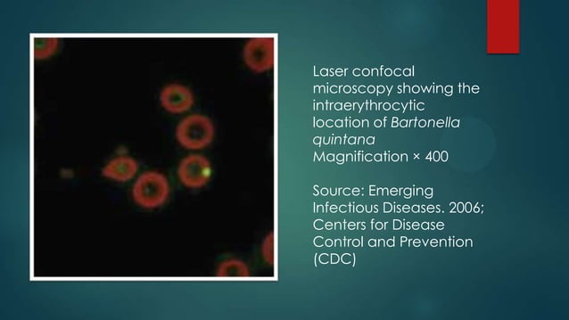 Trench fever | PPTX | Infectious Diseases | Diseases and Conditions