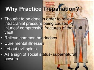 Trepanation Presentation by Karrah Christenson Session 8 2012 | PPTX