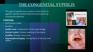 Treponema pallidum disease symptoms (3).pptx