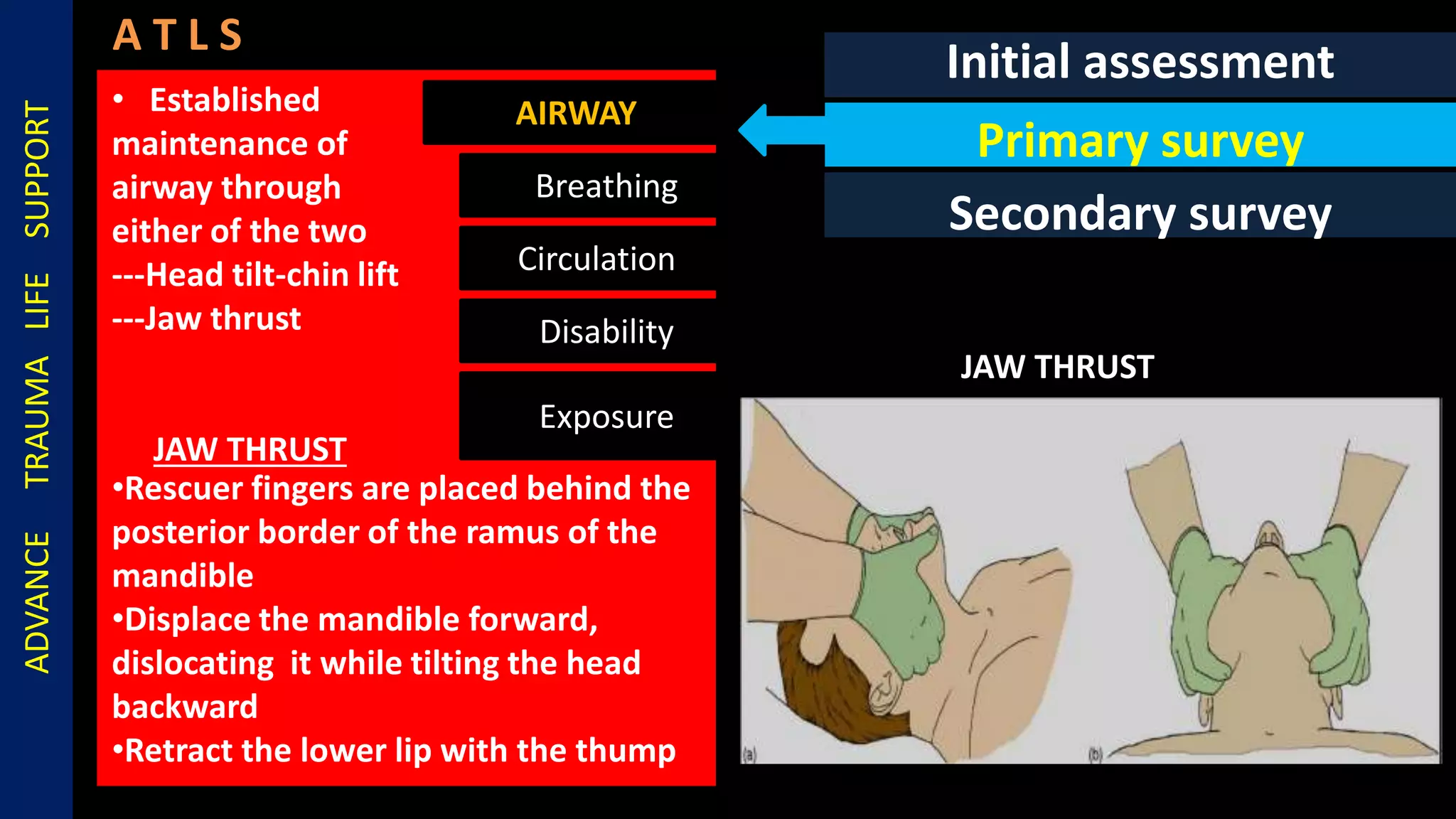 Triage | PPTX