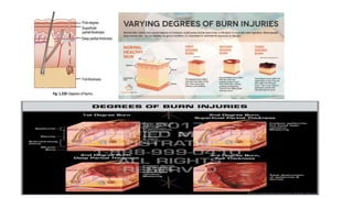 Triage,burn & tpn | PPTX