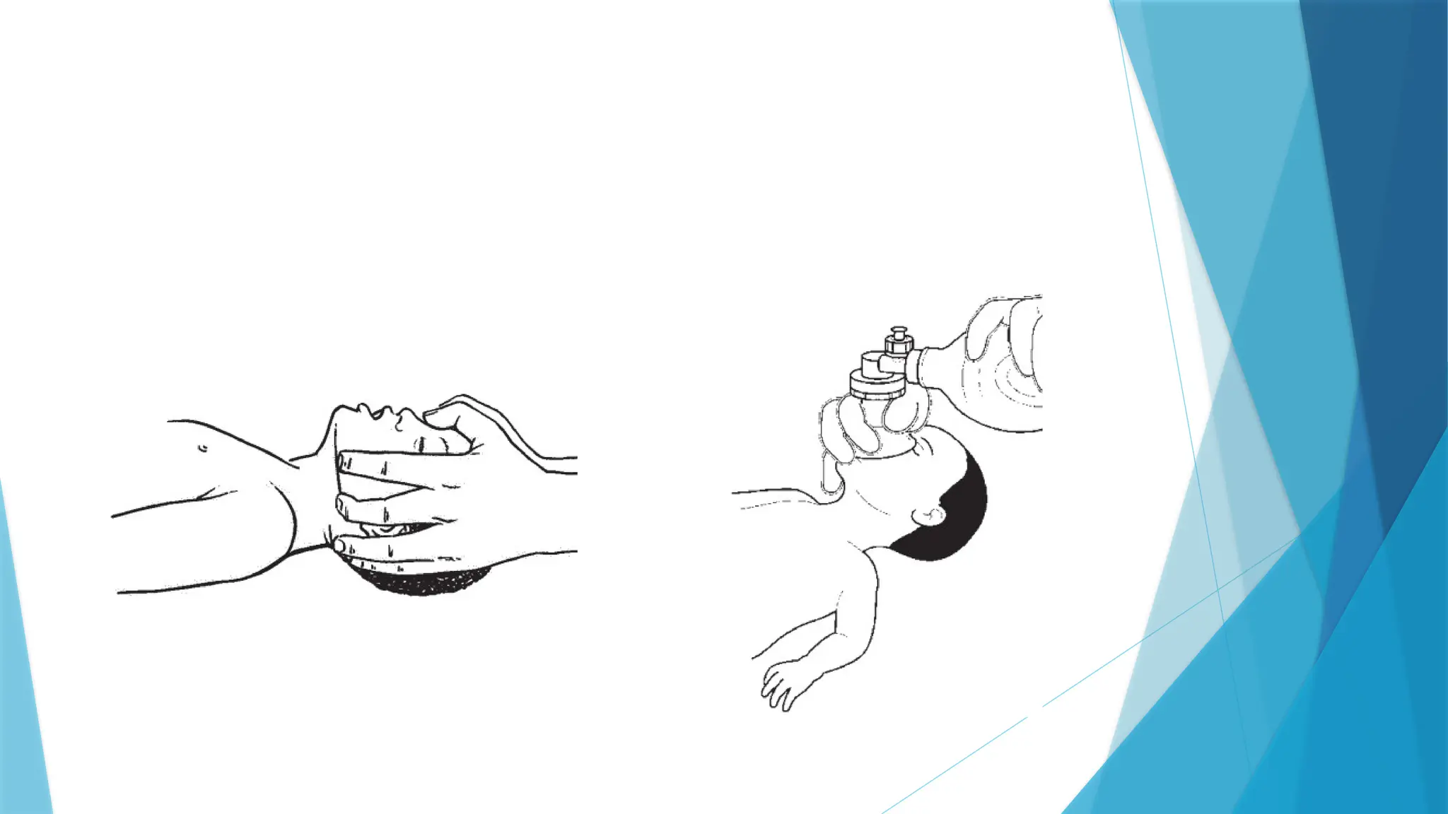 TRIAGING IN THE EMERGENCY paediatric unit.pptx