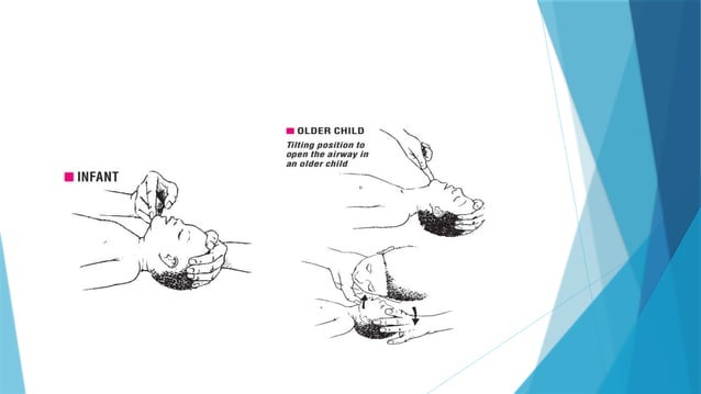 TRIAGING IN THE EMERGENCY paediatric unit.pptx | First Aid | Injuries