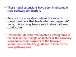 Triangle of koch | PPTX