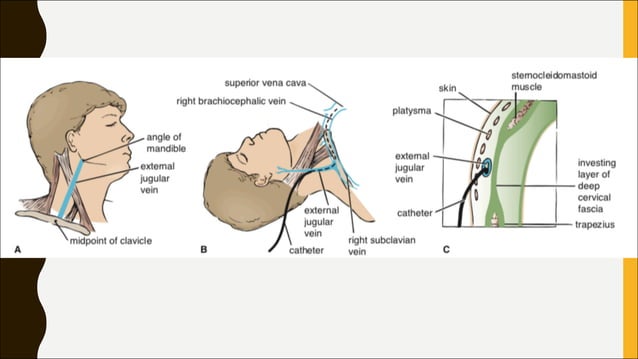 Surgical anatomy of Triangles of neck omfs | PDF | Heart and ...