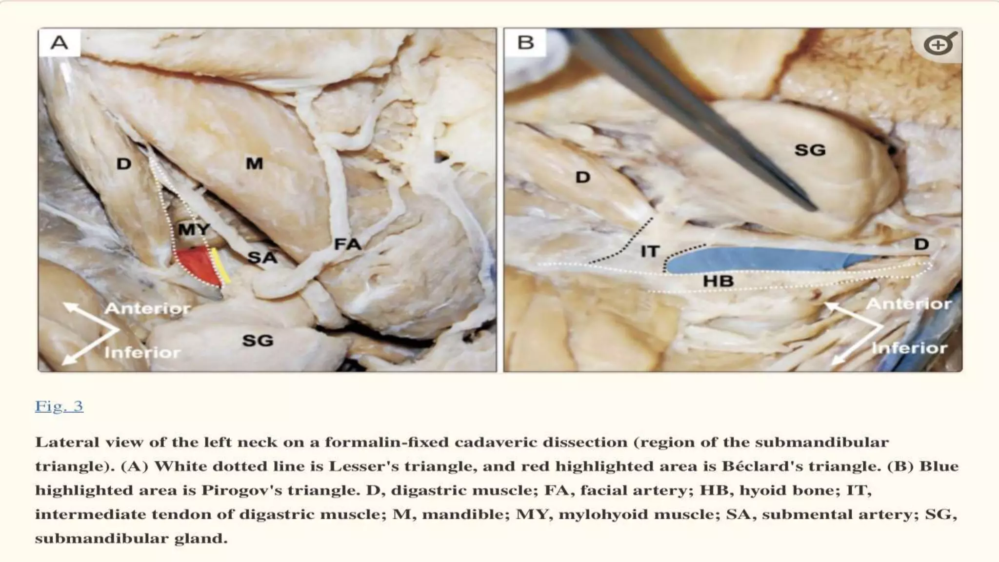 TRIANGLES OF NECK & APPLIED ANATOMY.pptx