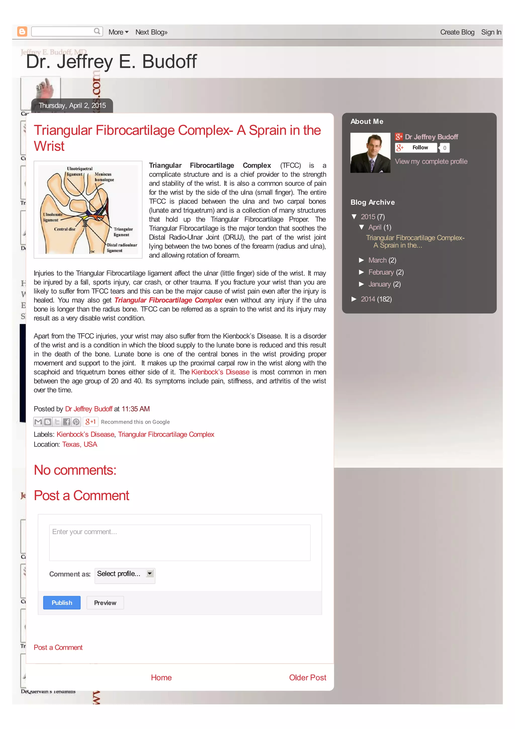 Triangular Fibrocartilage Complex - A Sprain in the Wrist | PDF