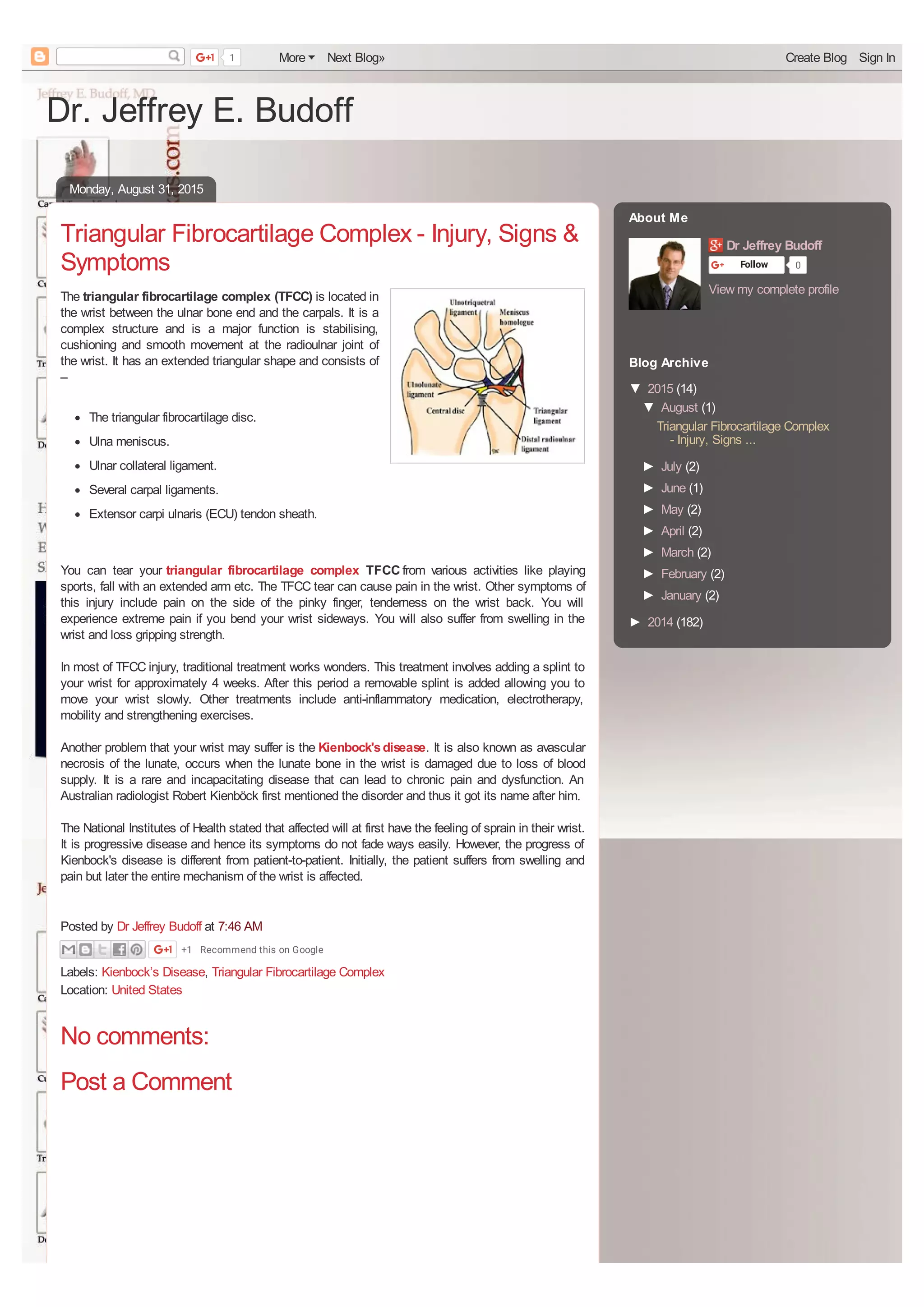 Triangular Fibrocartilage Complex - Injury, Signs & Symptoms | PDF