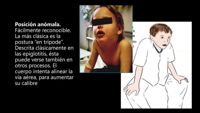 TEP TRIANGULO DE EVALUACION PEDIATRICA.pptx