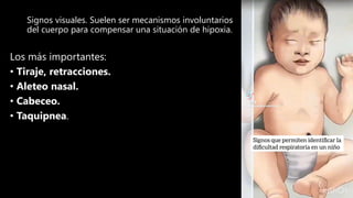 TEP TRIANGULO DE EVALUACION PEDIATRICA.pptx