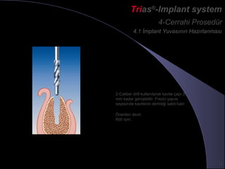Trias implant system | PPT