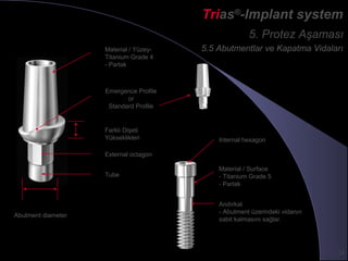 Trias implant system | PPT