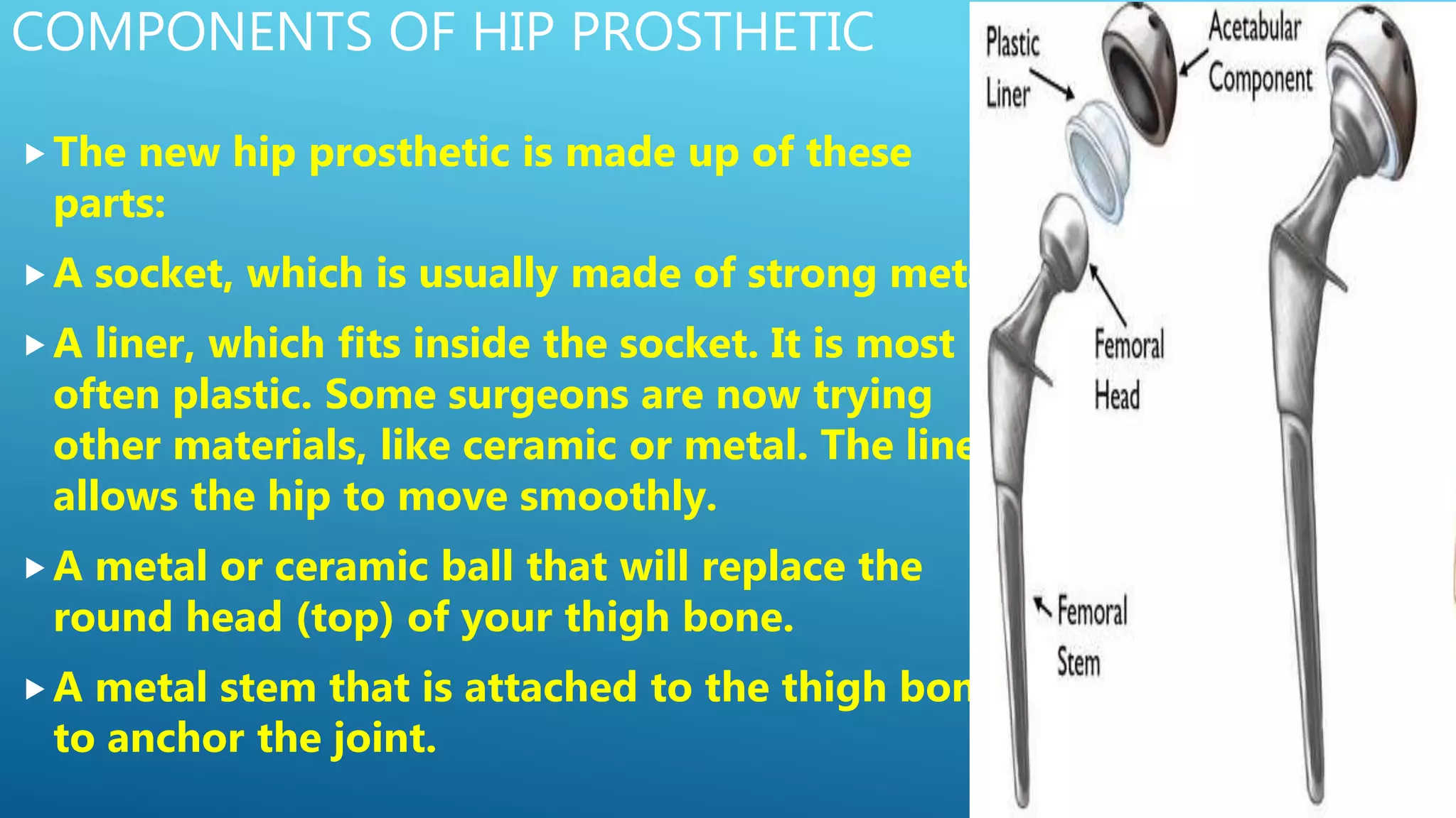 Tribological study of hip prosthesis _ Animesh Kumar, 118CR0130.pptx
