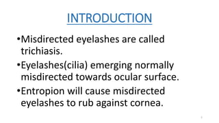 Trichiasis | PPTX