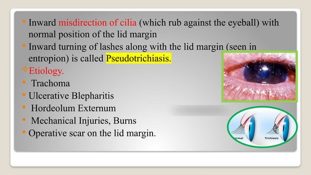 Trichiasis, pseudotrichiasis,etiology.pptx