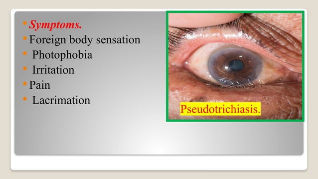 Trichiasis, pseudotrichiasis,etiology.pptx