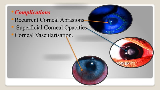 Trichiasis, pseudotrichiasis,etiology.pptx