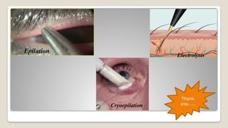 Trichiasis, pseudotrichiasis,etiology.pptx