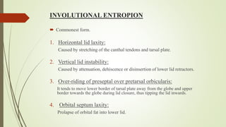 Trichiasis entropion | PPTX | Eye and Vision Conditions | Diseases and ...