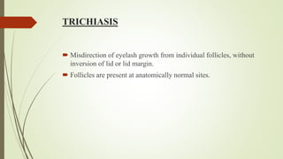 Trichiasis entropion | PPTX