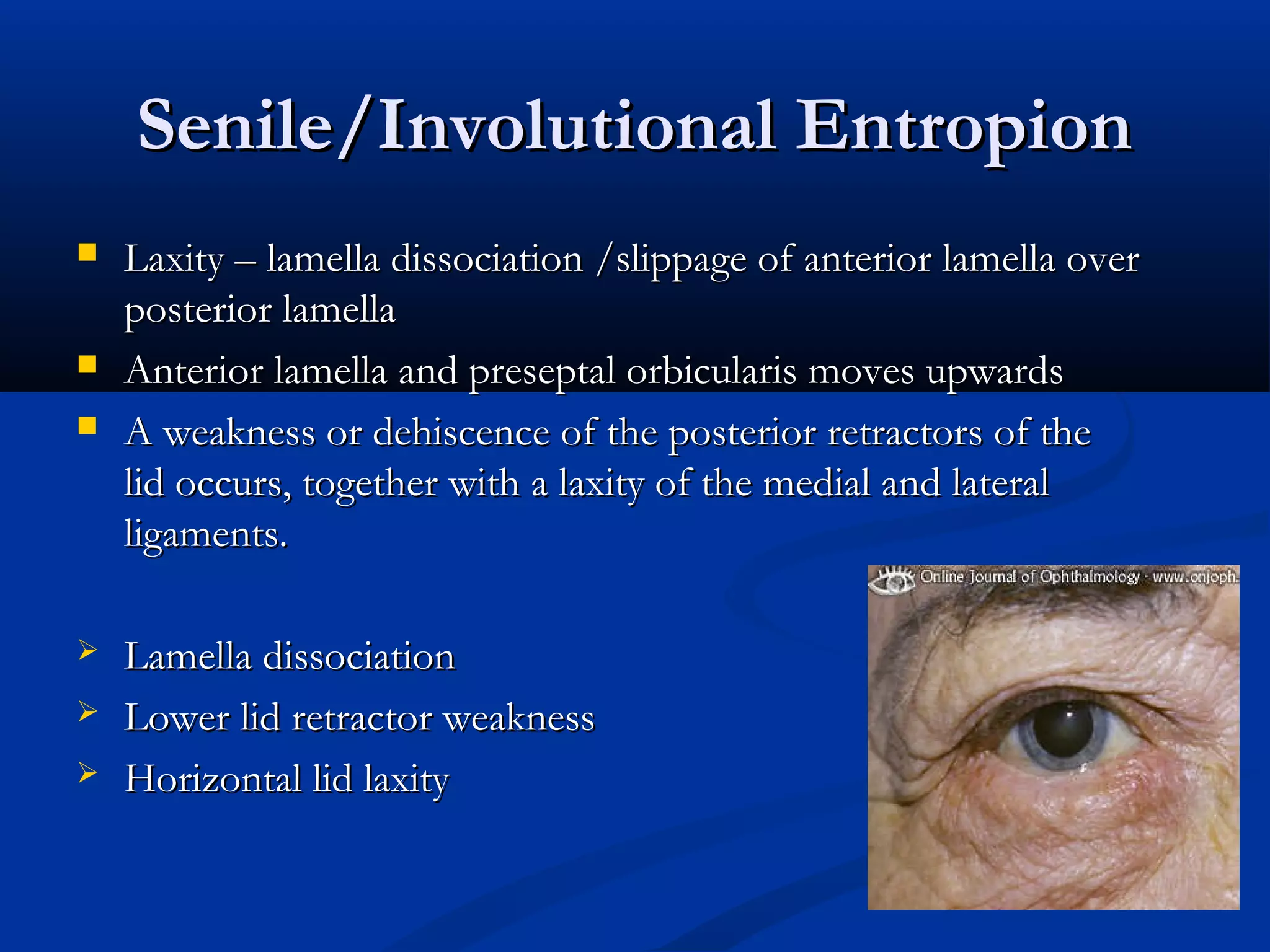 Ectropion and entropion | PPT