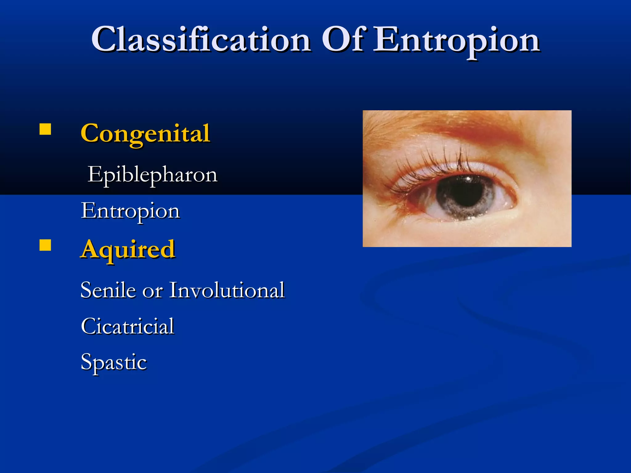 Ectropion and entropion | PPT