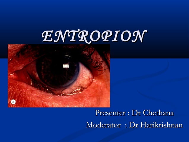 Ectropion and entropion | PPT