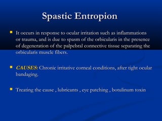 Ectropion and entropion | PPT