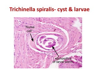 Trichinella Spiralis Encysted Larvae Labelled