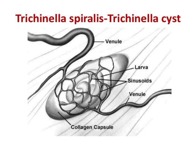 Trichinella spiralis