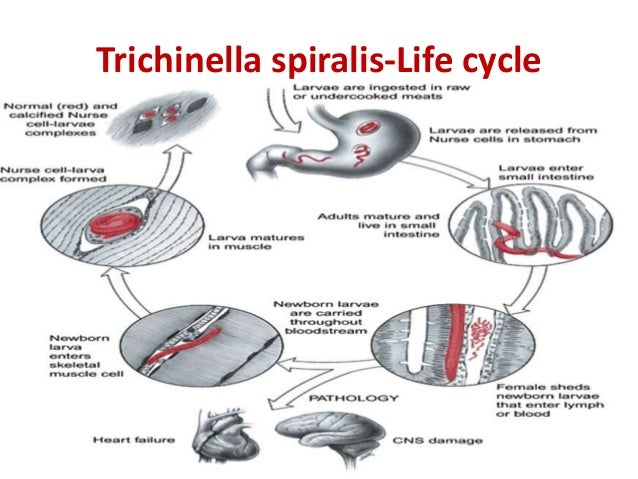 Trichinella spiralis