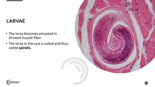 Trichinella Spiralis Encysted Larvae Labelled
