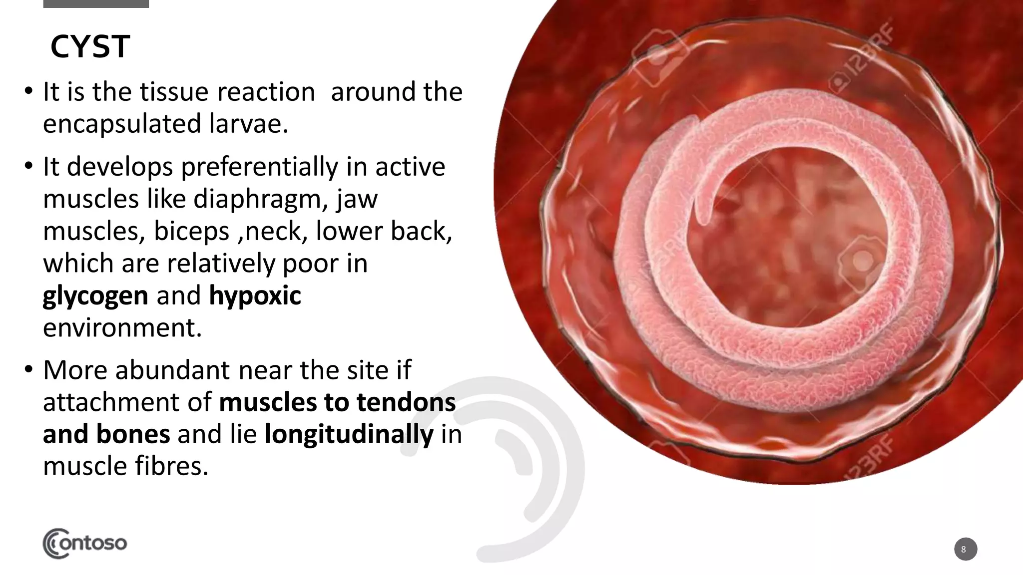trichinella spiralis.pptx