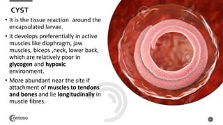 trichinella spiralis.pptx