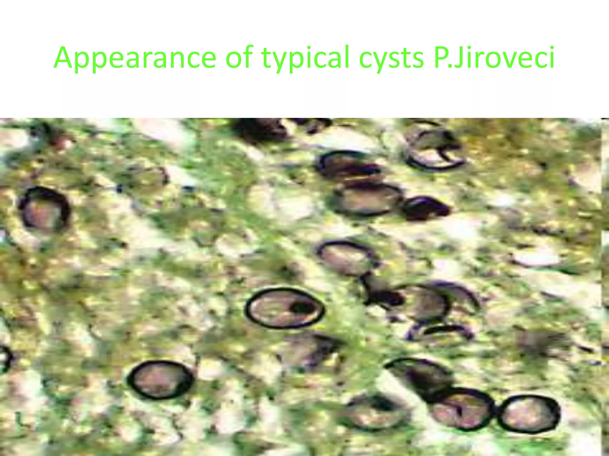 Trichomonas & Pneumocystis | PPT