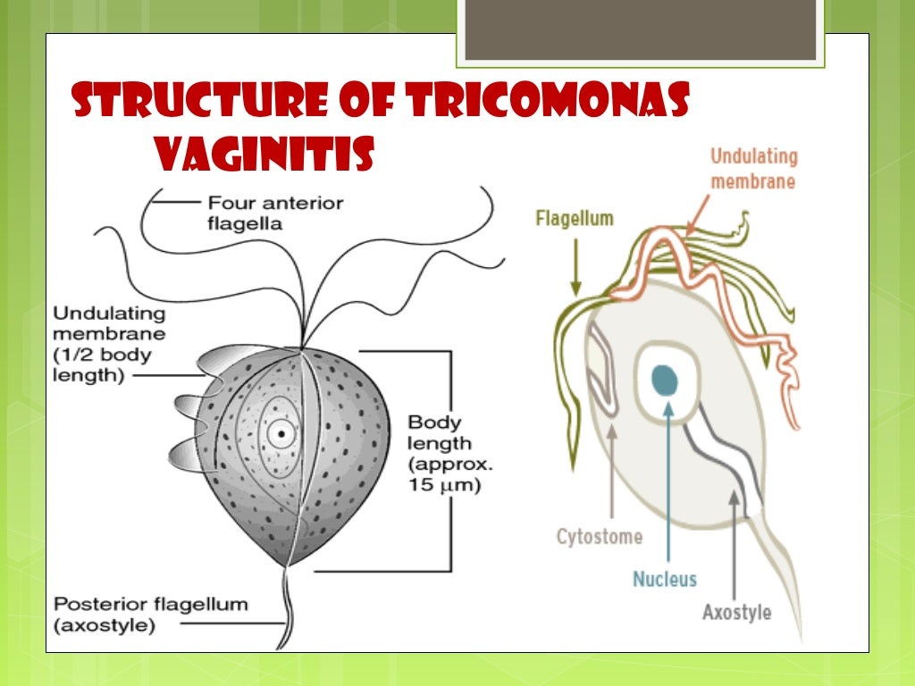 Trichomonas vaginalis