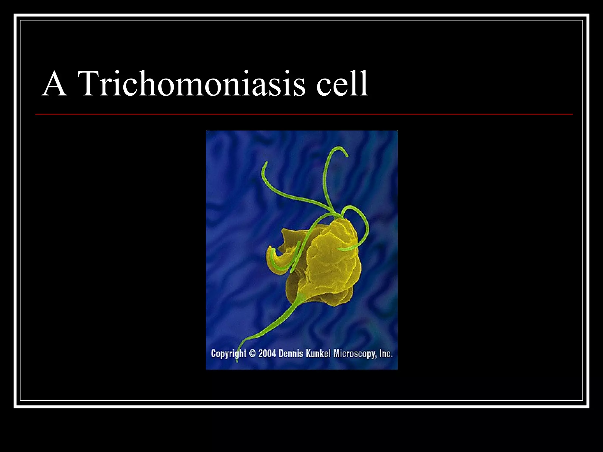 Trichomoniasis | PPT