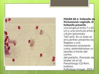Trichomoniasis | PPT