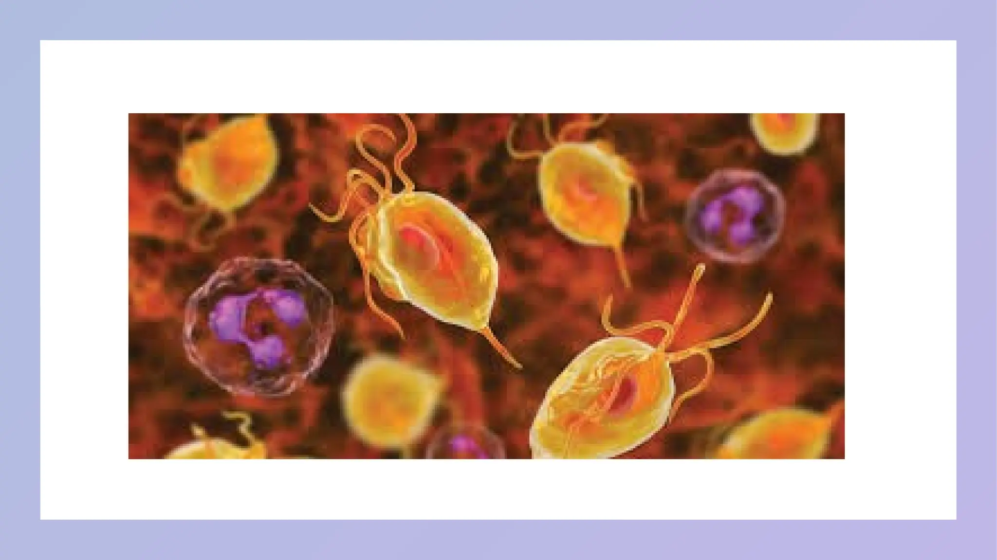 Trich is caused by a one-celled protozoan organism called Trichomonas ...