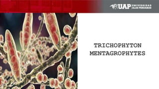 TRICHOPHYTON (7).pptx