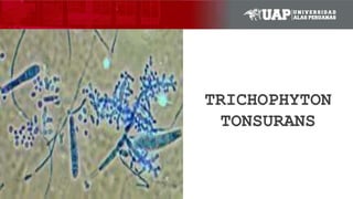 TRICHOPHYTON (7).pptx