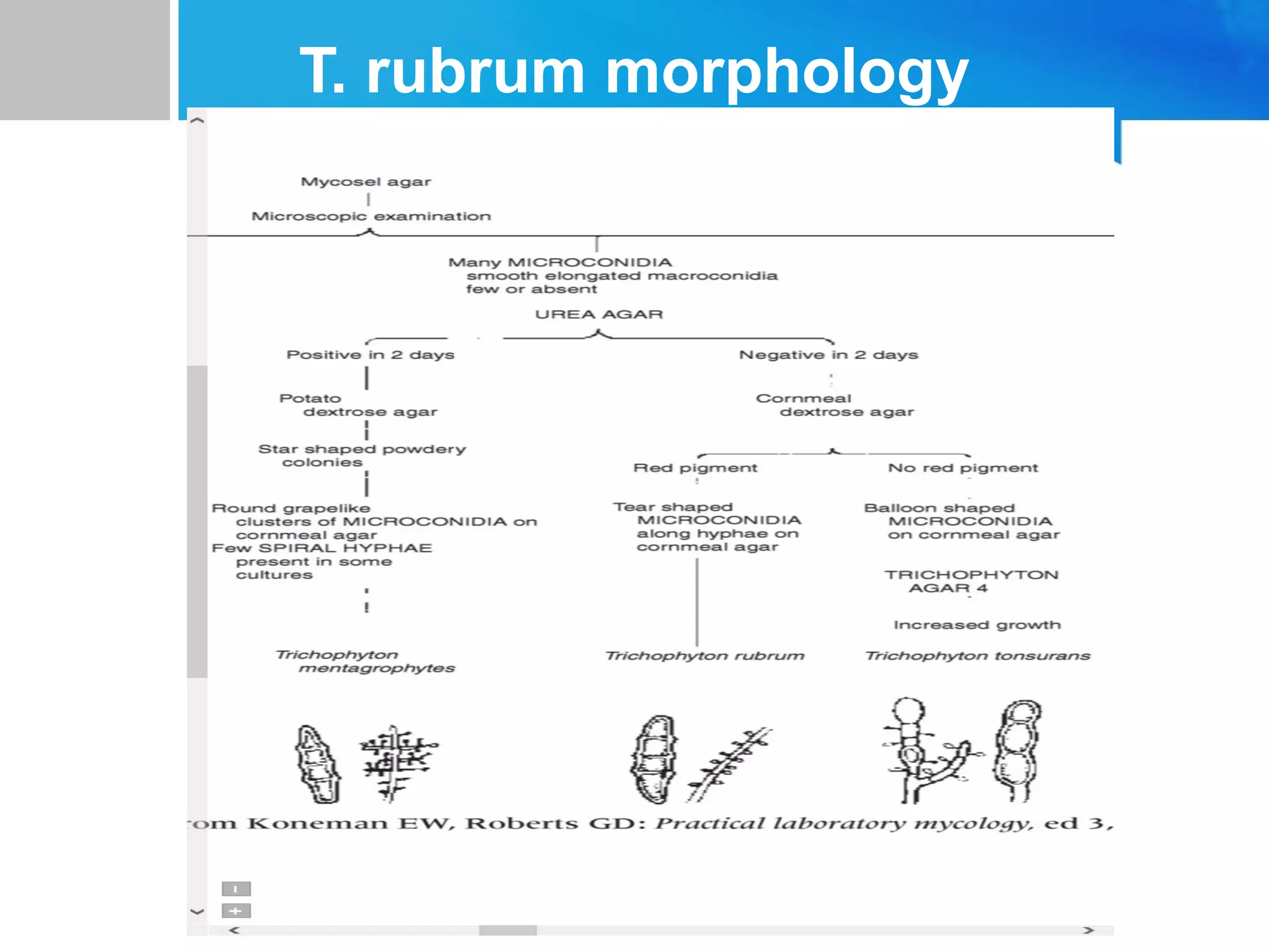 Trichophyton and Epidermophyton | PPT