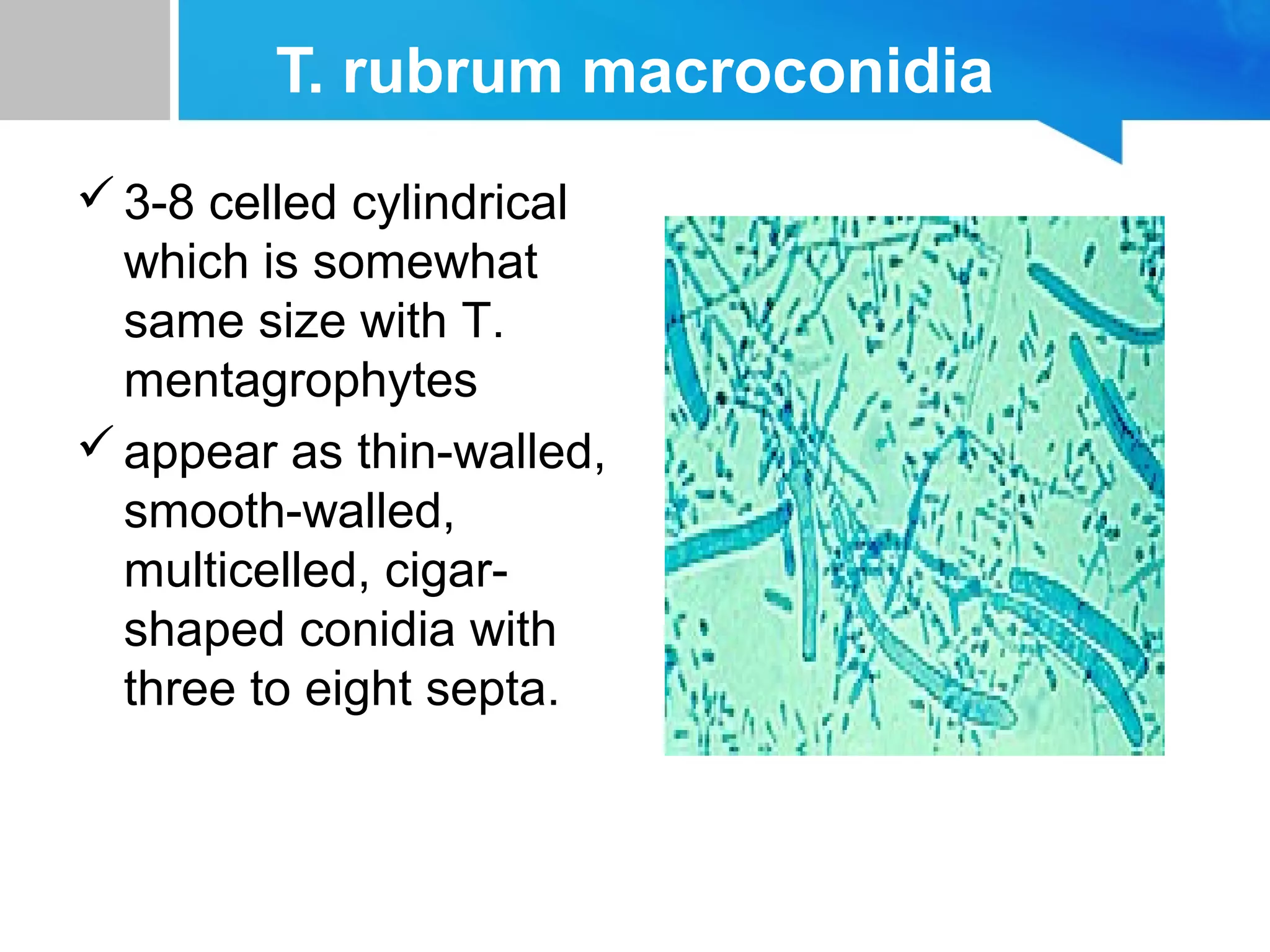 Trichophyton and Epidermophyton | PPT
