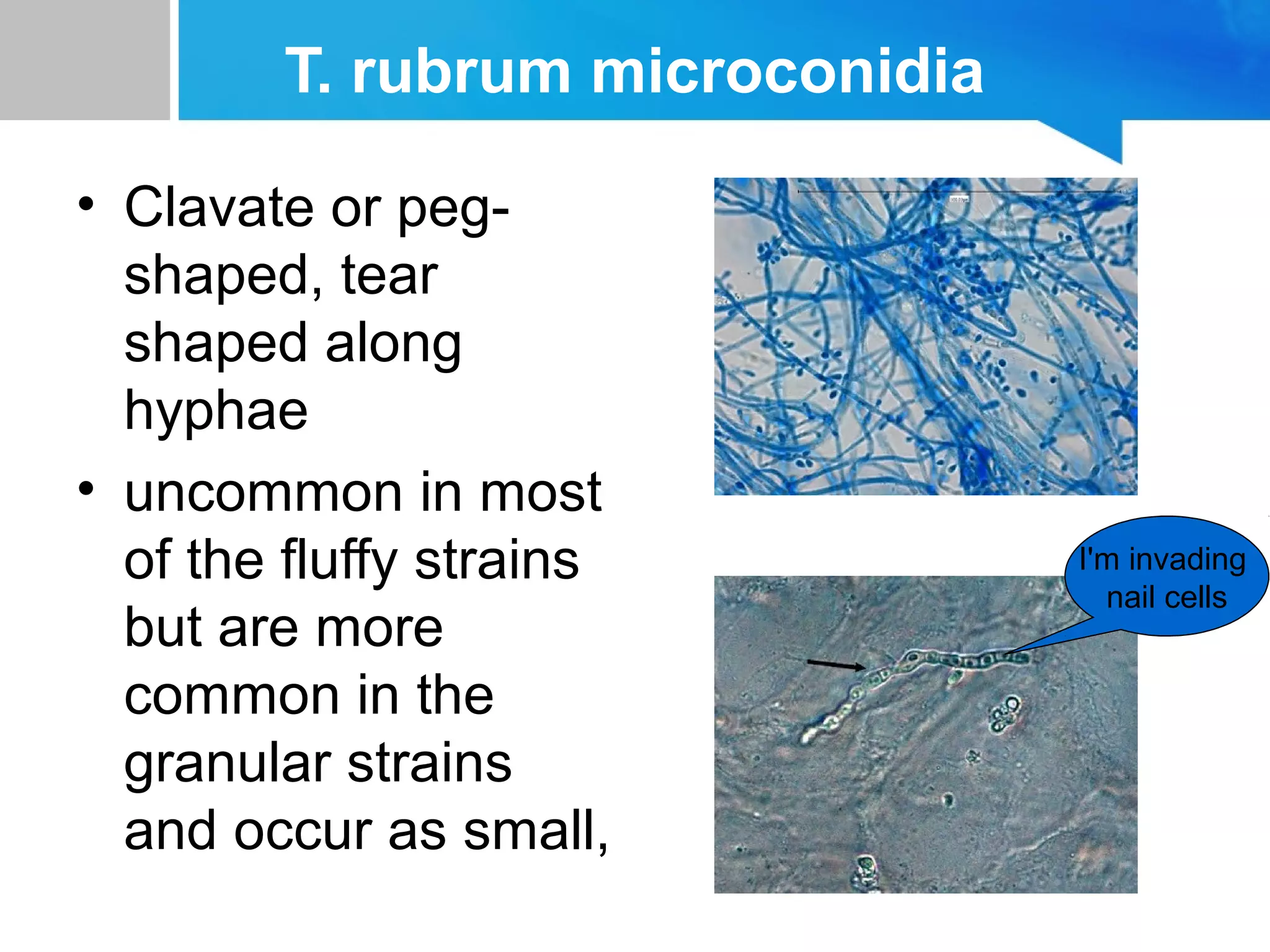 Trichophyton and Epidermophyton | PPT