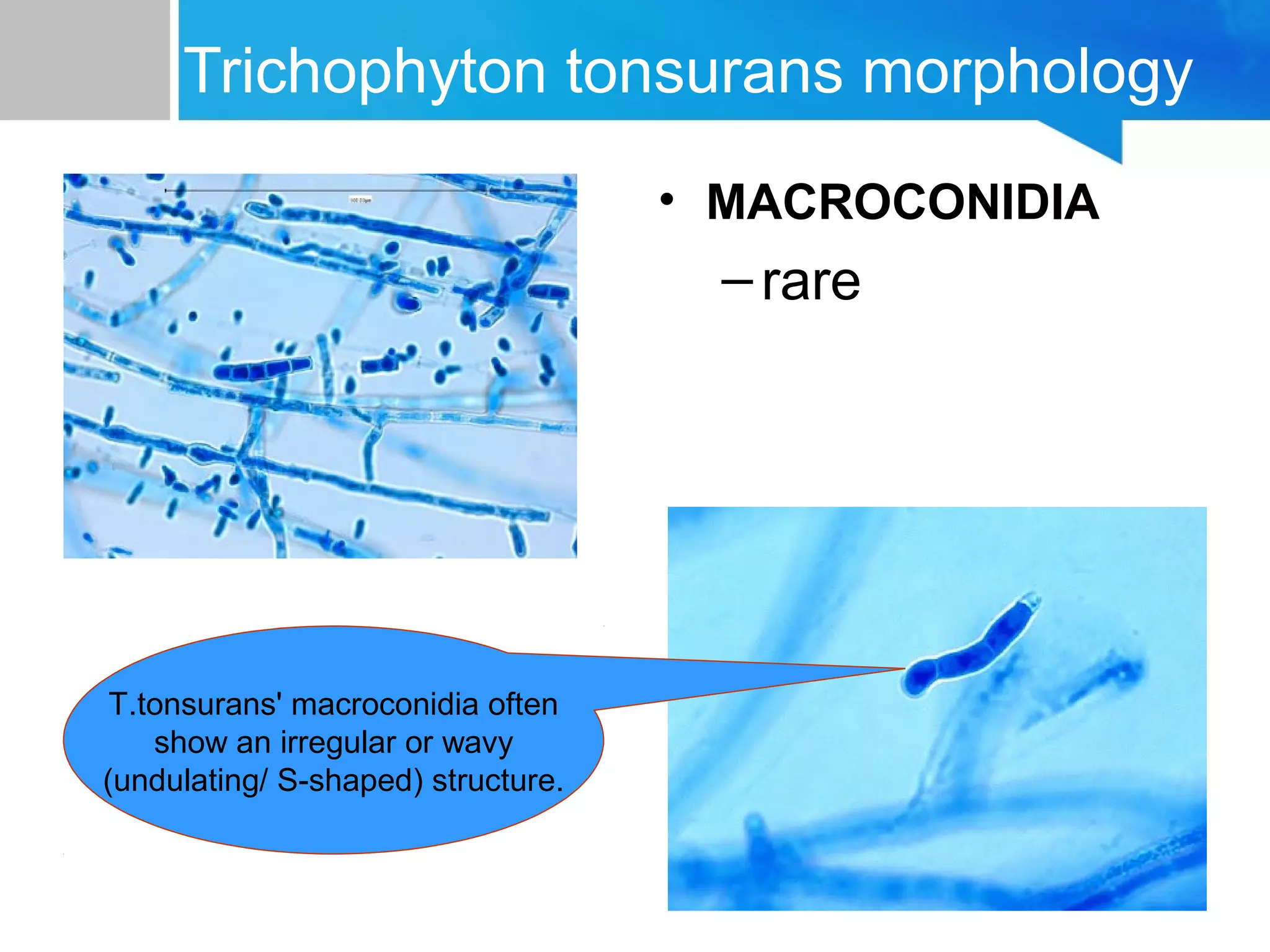 Trichophyton and Epidermophyton | PPT