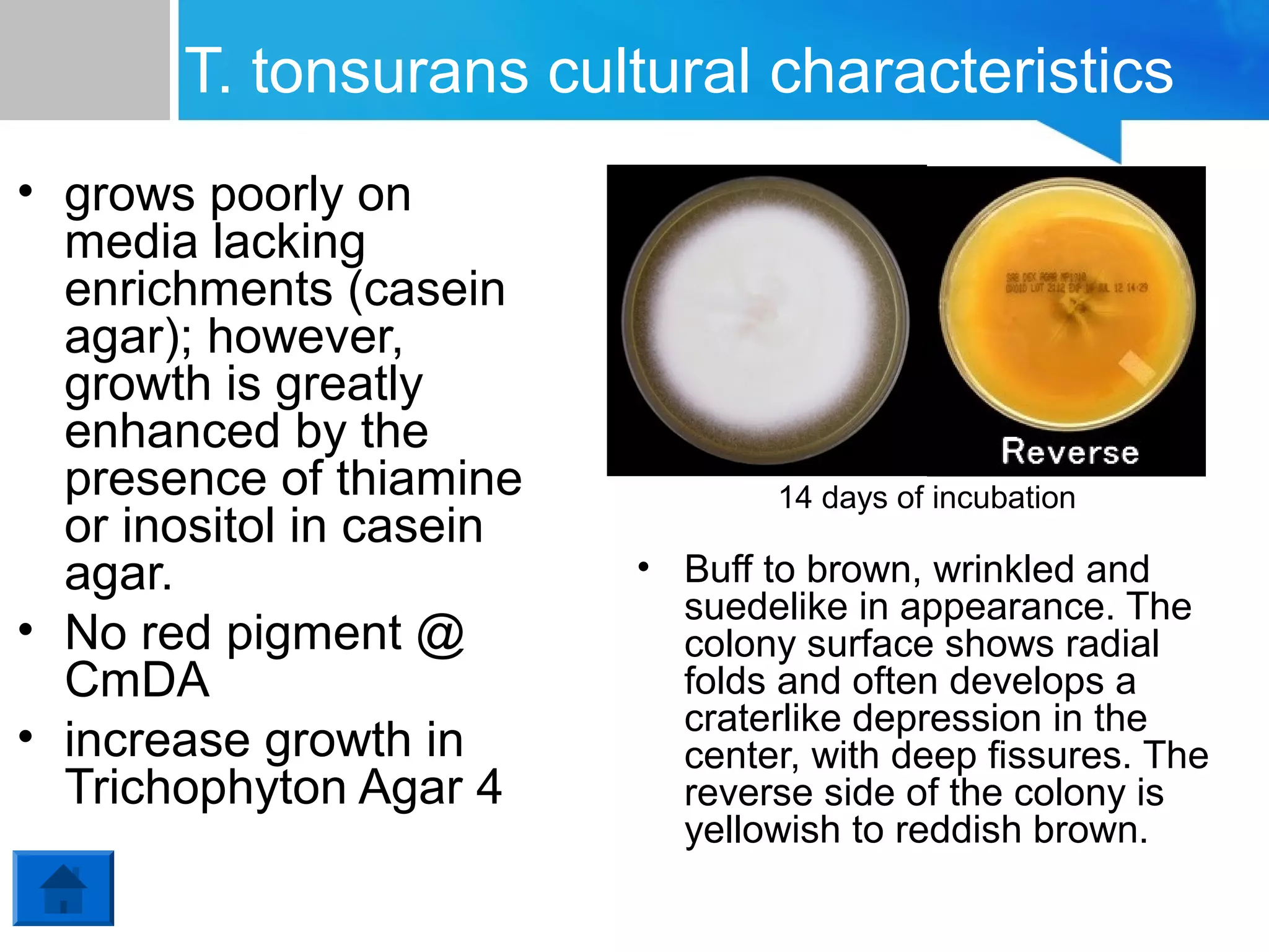 Trichophyton and Epidermophyton | PPT