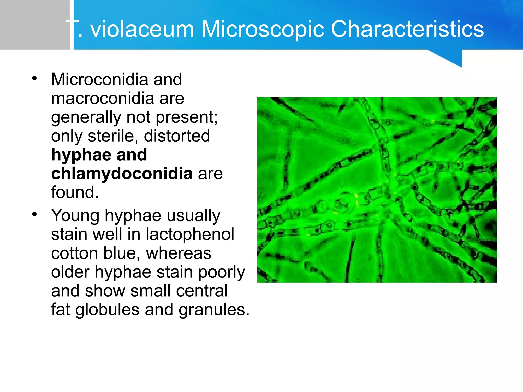 Trichophyton and Epidermophyton | PPT