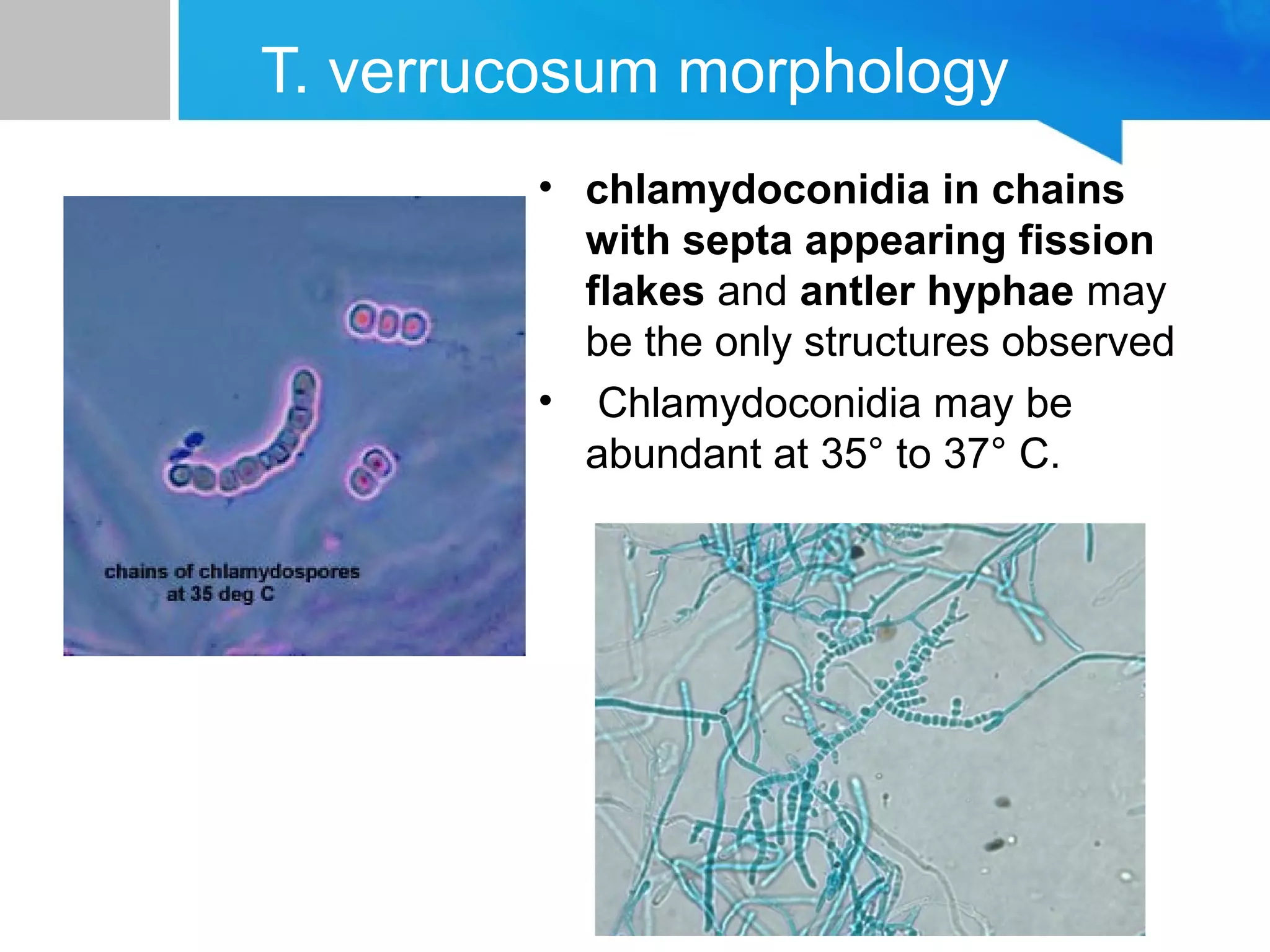 Trichophyton and Epidermophyton | PPT